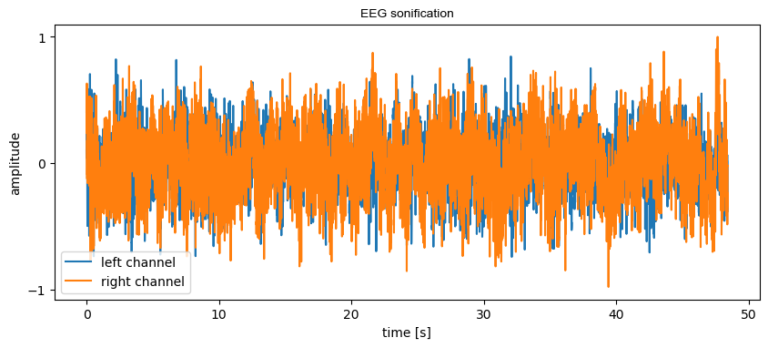 EEG Data Sonification – Daniel Maszkowicz